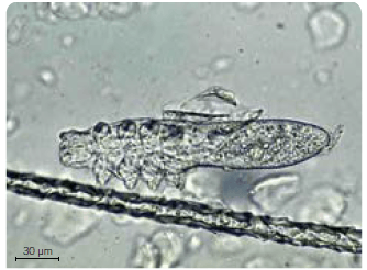 Demodicose: como abordar a sarna demodécica em cães e gatos